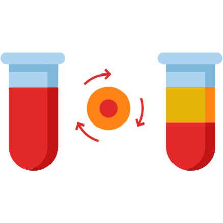 PRF Platelet Rich Fibrin | Aesthetic Medicine & Semi Permanent Makeup ...