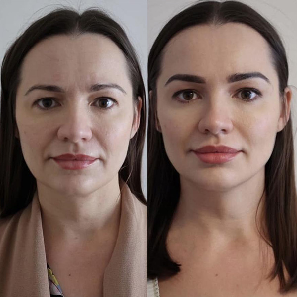 Monaco Royal Lifting | Aesthetic Medicine & Semi Permanent Makeup Preston