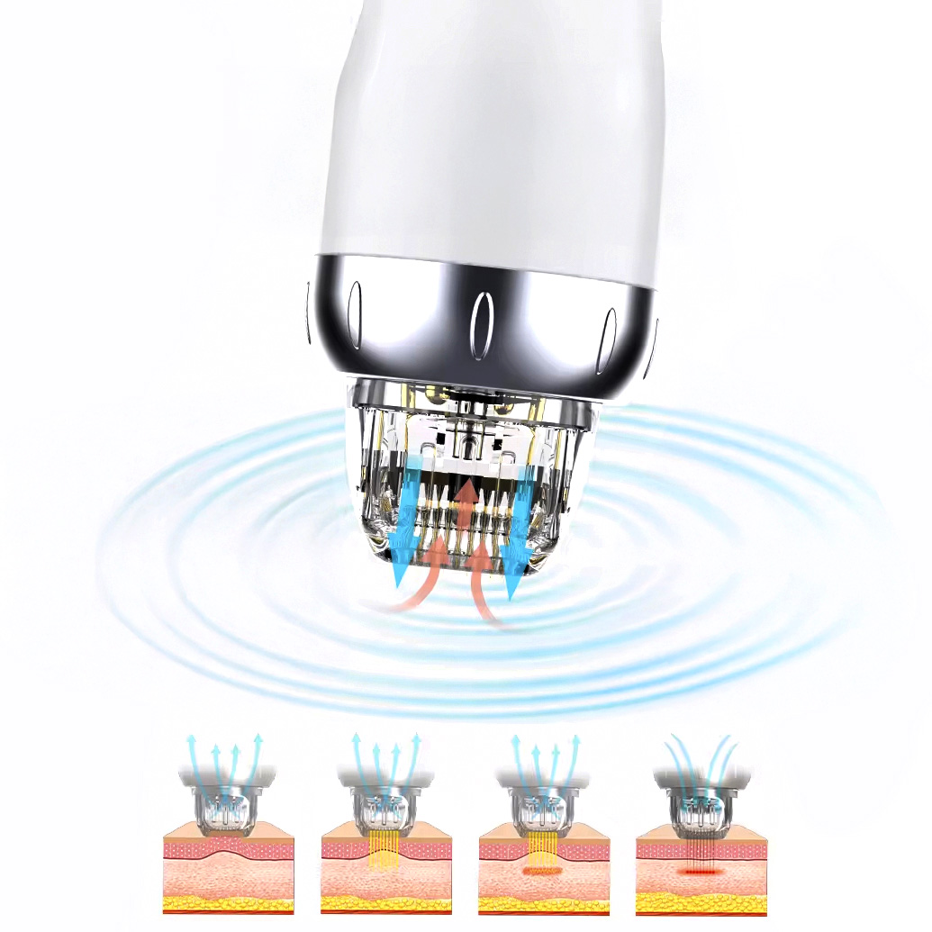 RF Microneedle Radiofrequency | Aesthetic Medicine & Semi Permanent ...